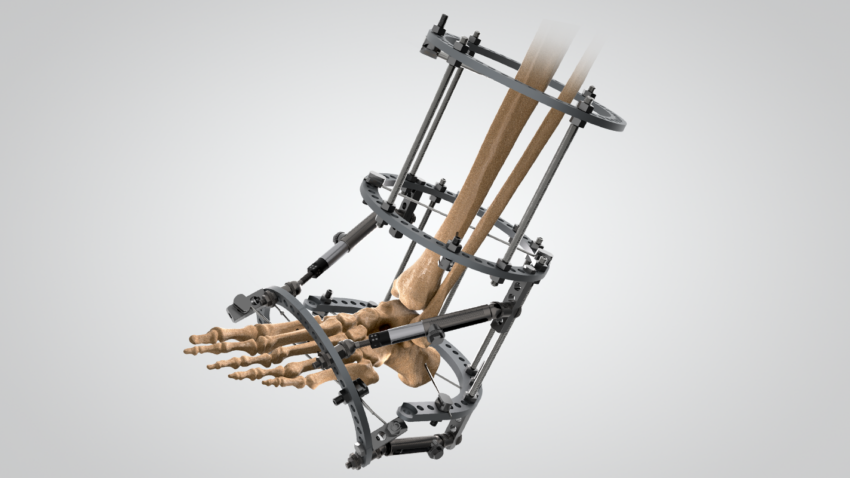 Orthofix - Medical Devices & Solutions