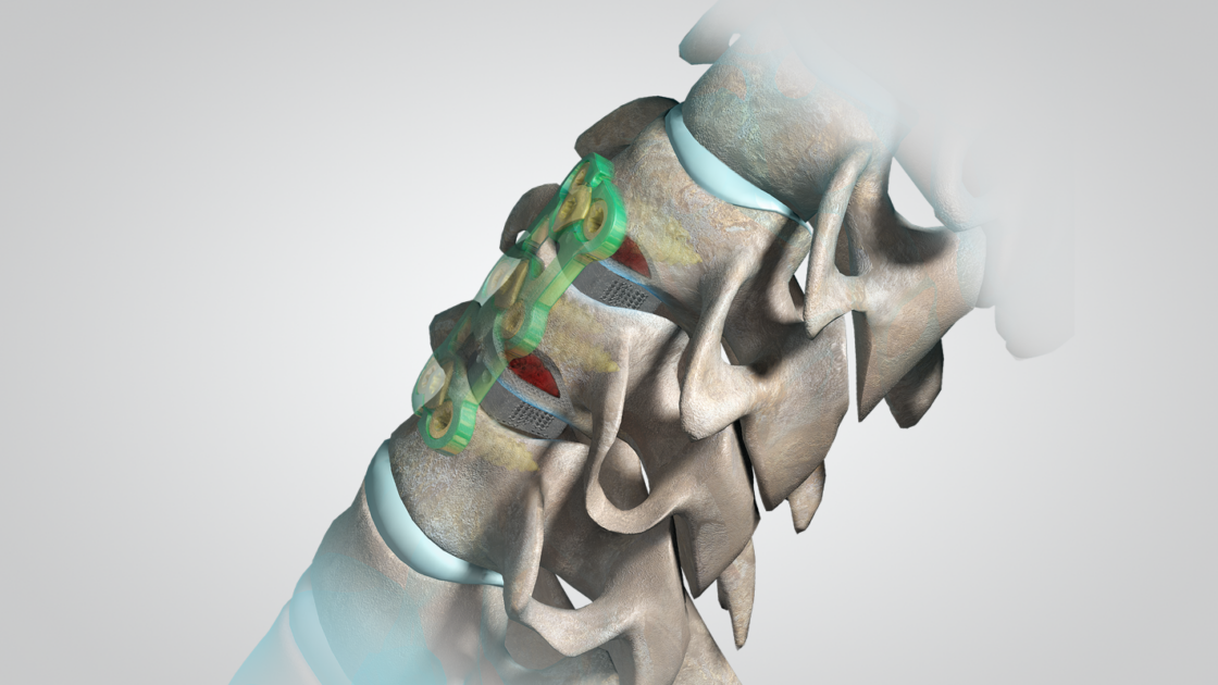Orthofix - Medical Devices & Solutions