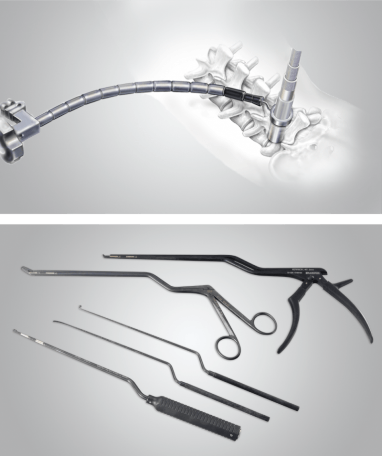 ProView (MAP) Tubular Retractor System - Orthofix