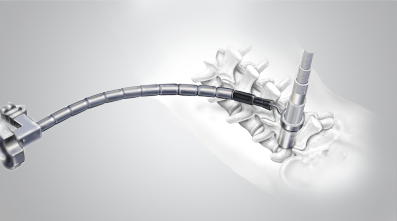 ProView (MAP) Tubular Retractor System - Orthofix