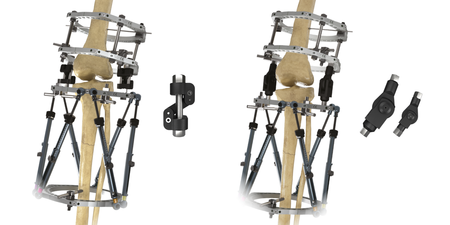 Orthofix Introduces New Phantom and Tornado Hinges for TrueLok Ring ...