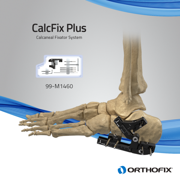 Orthofix Announces First Patient Procedures and Full Commercial Launch ...