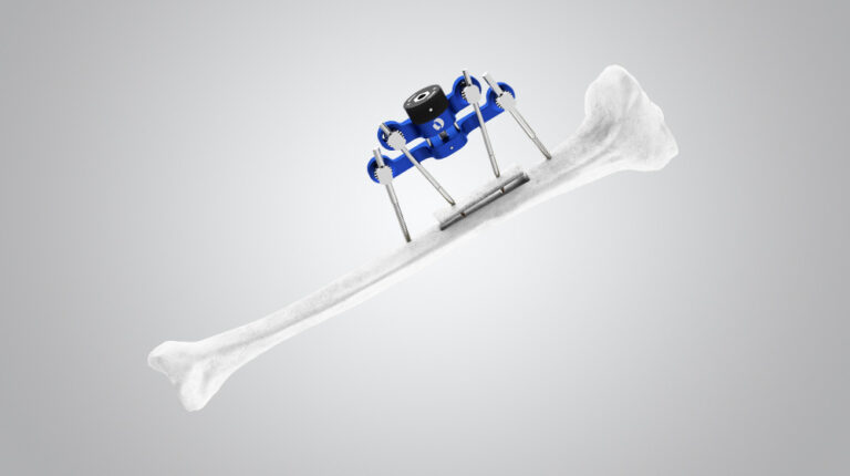 Solutions - Orthofix